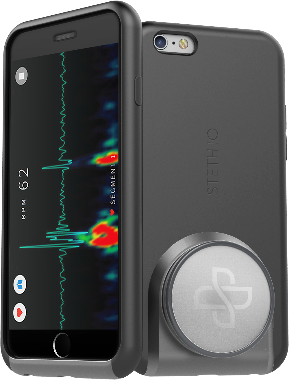 Steth IO | The Smartphone Stethoscope